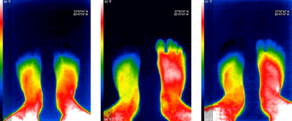 Pro Series Footlight with pulsed magnetic technology – Bedrock Bioscience